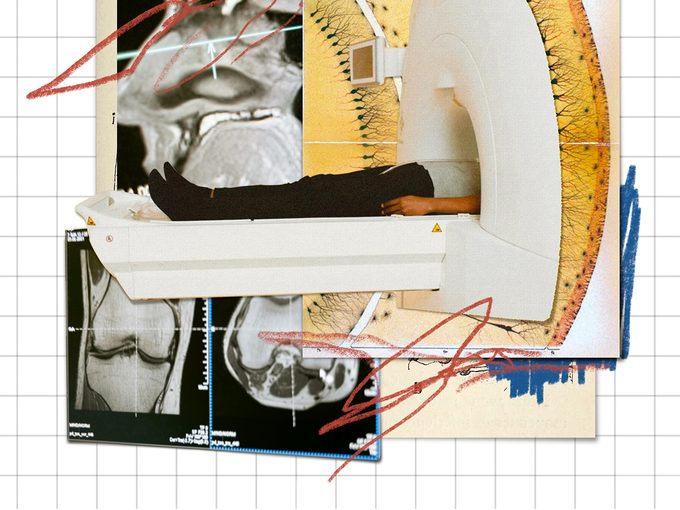 Are Whole-Body MRI Scans Too Good to Be True? - Fitness, Nutrition, Sex ...